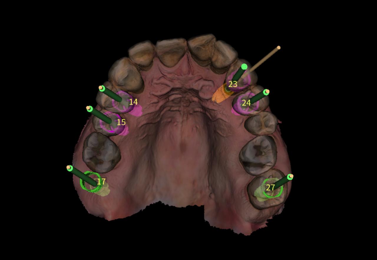 CBCT Imaging | Diagnostics with 3D Precision | Dr. Savyon