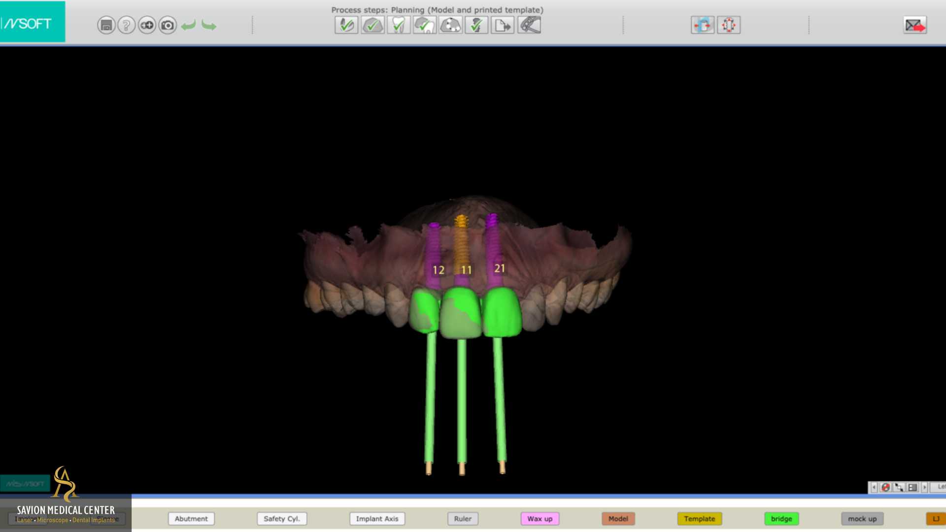 CBCT Imaging | Diagnostics with 3D Precision | Dr. Savyon