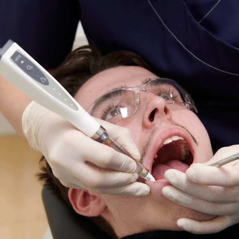 Laser lower wisdom tooth extraction | Painless | Dr savyon